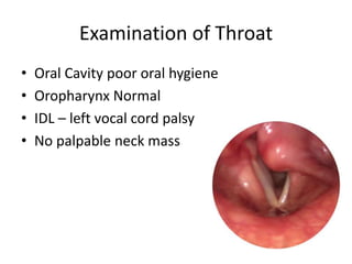 Interesting case of recurrent laryngeal nerve palsy | PPTX