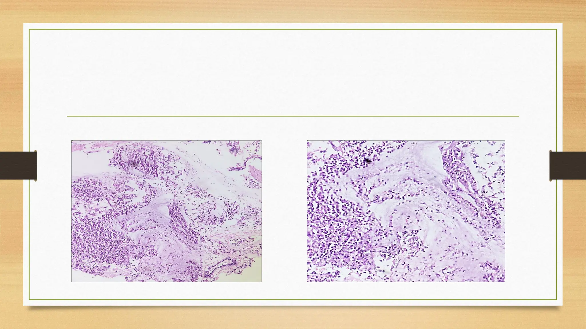 Interesting case pathology presentation.pptx