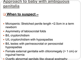 Ambiguous Genitalia | PPTX
