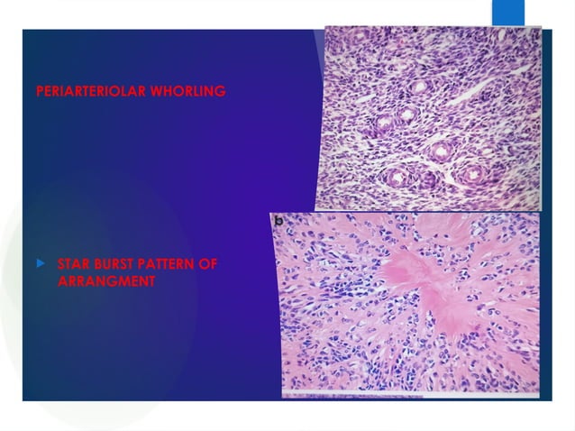Interesting case presentation- IOG (2) (1).pptx