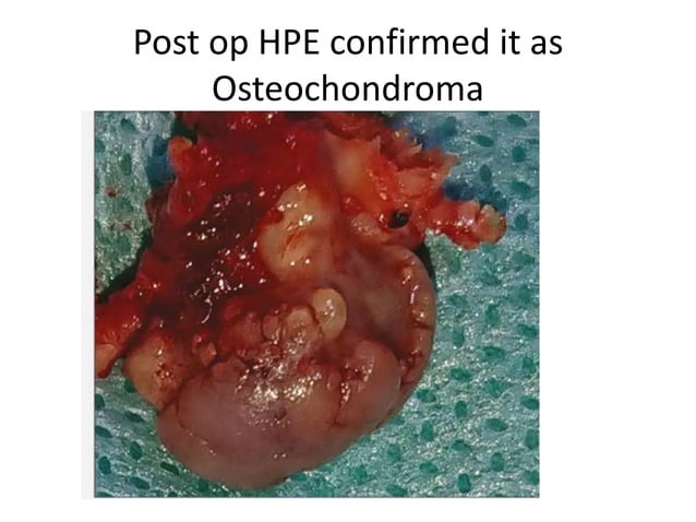 INTERESTING CASES.pptx