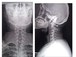 INTERESTING CASES.pptx