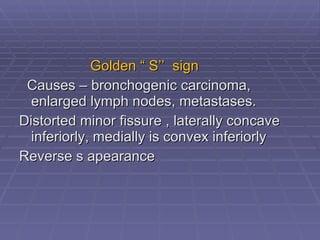 CXR: 'Silhoutte' and other signs | PPT