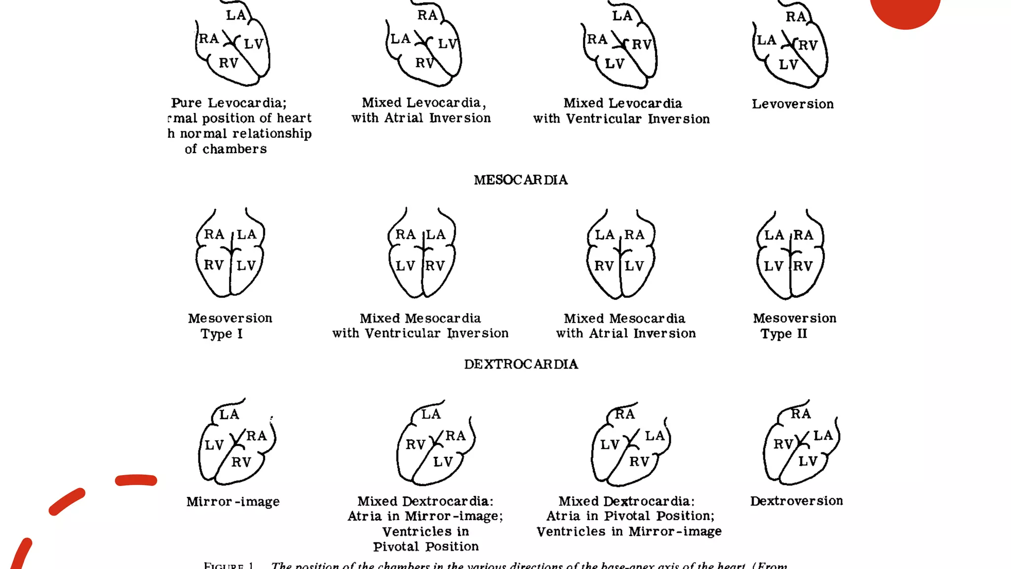 INTERESTING ECGS | PPTX