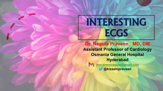 INTERESTING ECGS | PPT