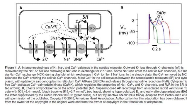 INTERESTING ECGS | PPTX