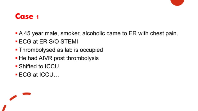 INTERESTING ECGS | PPTX