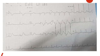 INTERESTING ECGS | PPTX
