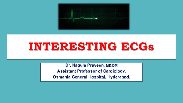 INTERESTING ECGS -- PART II | PPTX | Heart and Cardiovascular Diseases ...