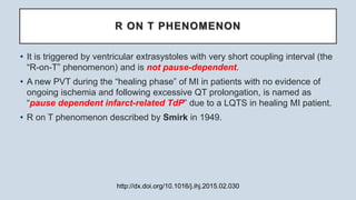 INTERESTING ECGS -- PART II | PPTX