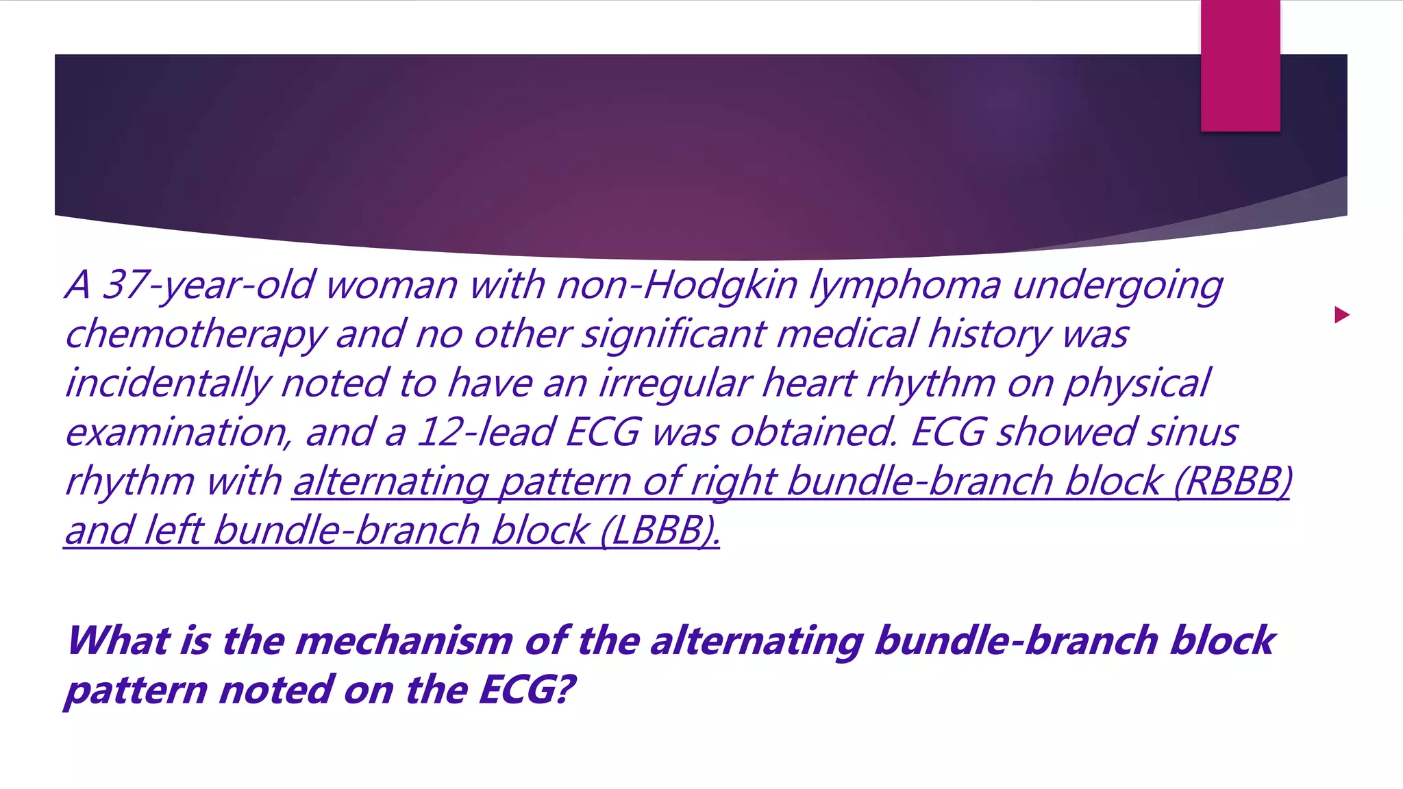 Interesting ecg tracing 1 Alternating Bundle Branch Block | PPTX