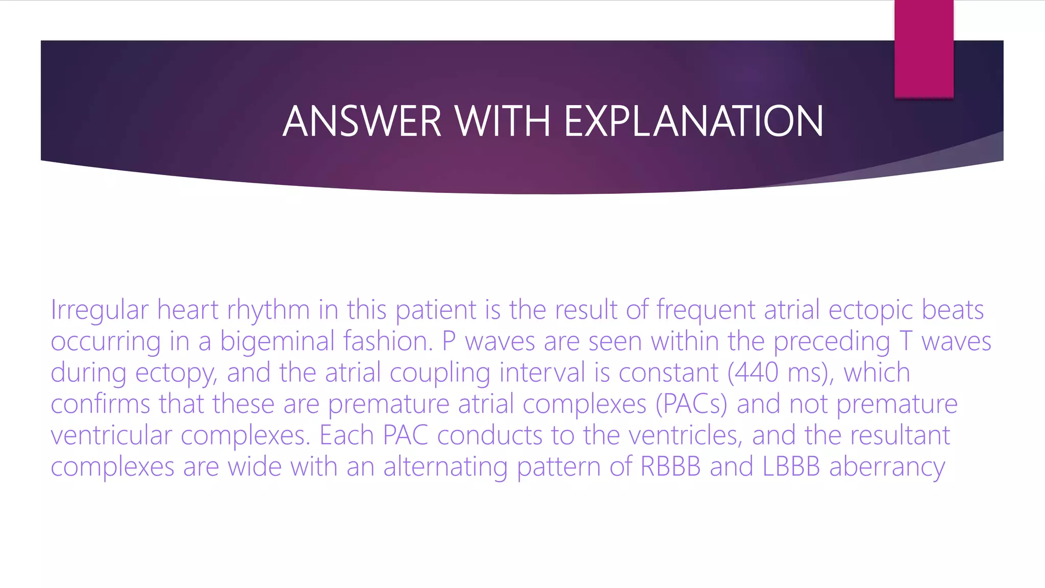 Interesting ecg tracing 1 Alternating Bundle Branch Block | PPTX