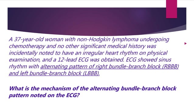 Interesting ecg tracing 1 Alternating Bundle Branch Block | PPT