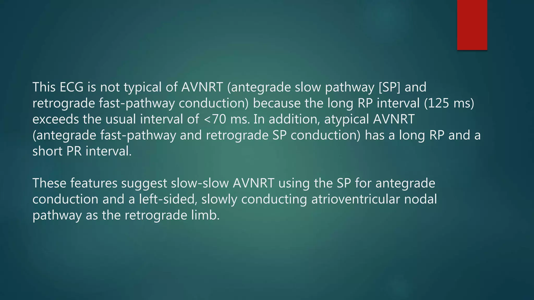 Interesting ecg tracing 2 SVT mechanism | PPTX