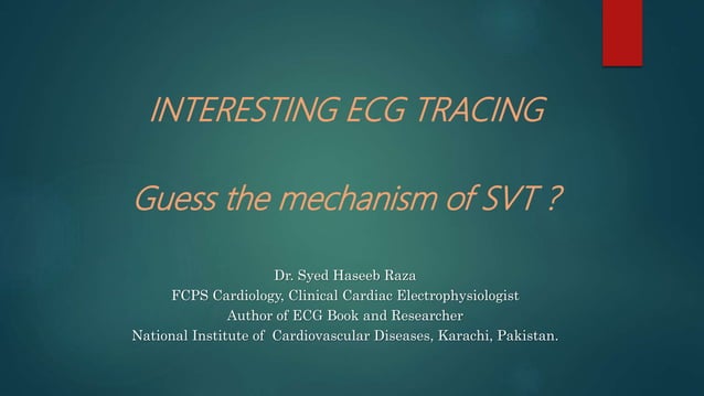 Interesting ecg tracing 2 SVT mechanism | PPT