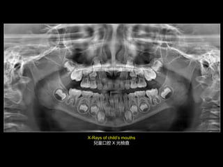 Interesting X-Rays (有趣的 X 光片).ppsx