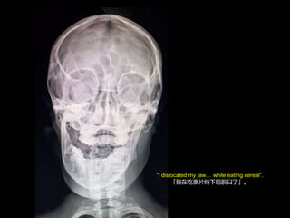 Interesting X-Rays (有趣的 X 光片).ppsx