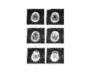 Interface between ris his & pacs | PPTX