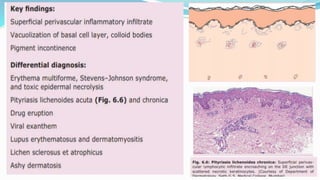 interface dermatitis.pptx