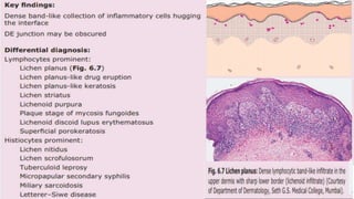 interface dermatitis.pptx