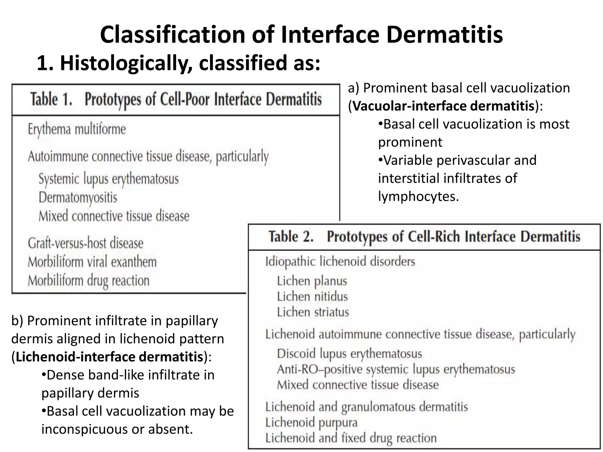 Interface dermatitis tutorial | PPTX