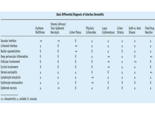 Interface dermatitis tutorial | PPTX | Skin and Dermatology | Diseases ...