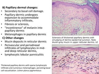 Interface dermatitis tutorial | PPTX
