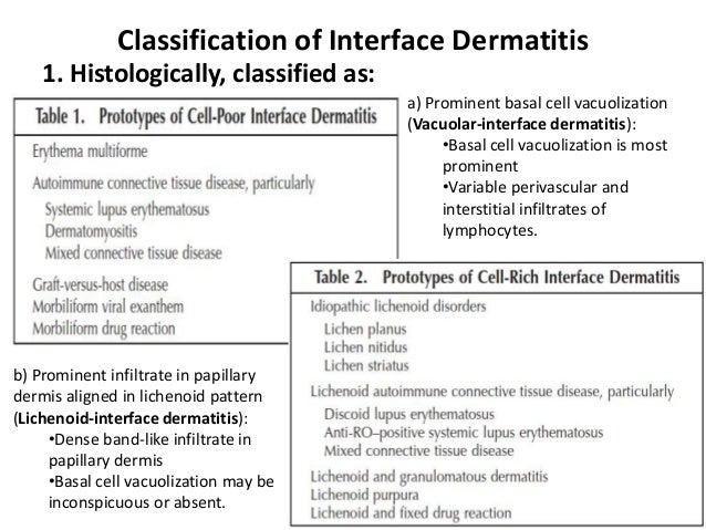Interface dermatitis tutorial