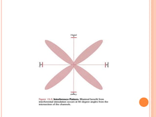 Interferential-Stimulation-Alternating-Currents (1).pptx