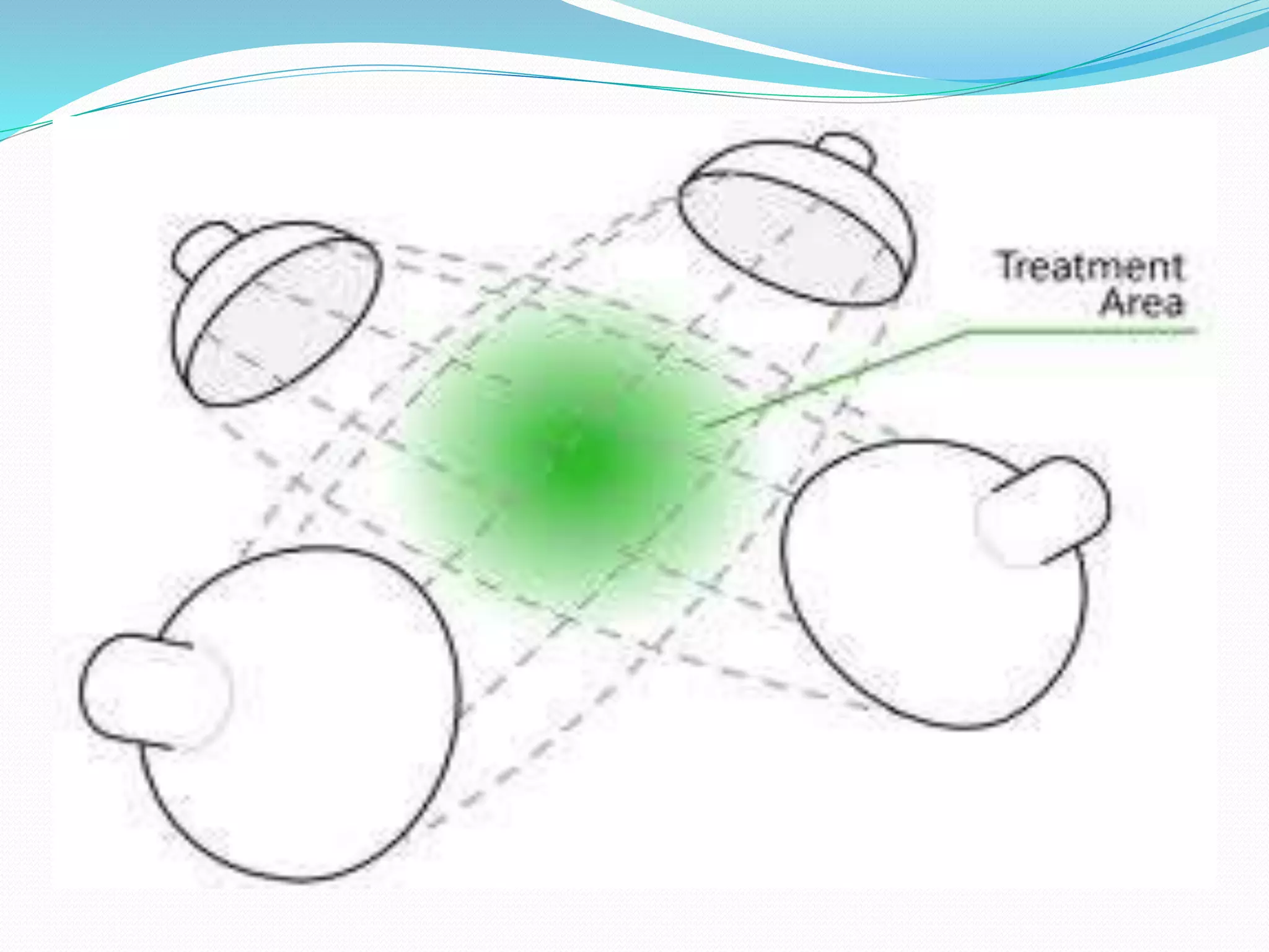 Interferential current | PPTX