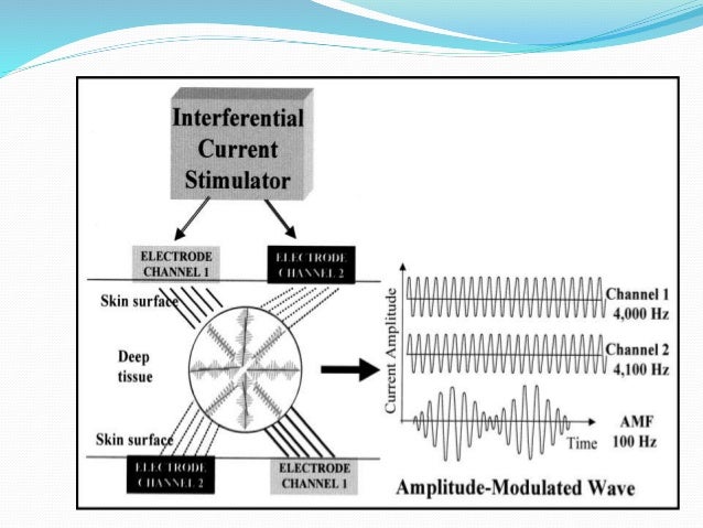 Interferential current
