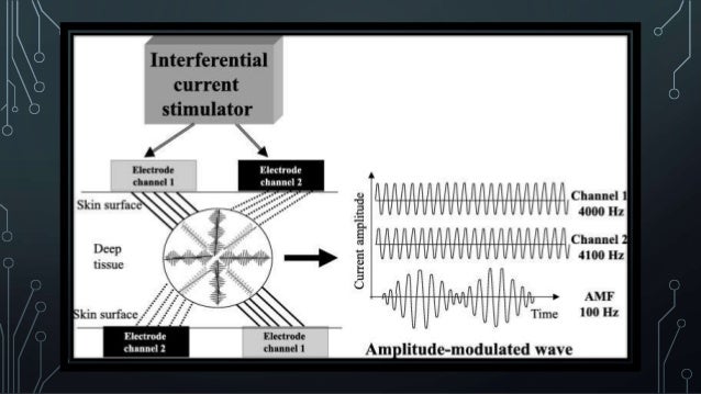 Interferential current (ifc)