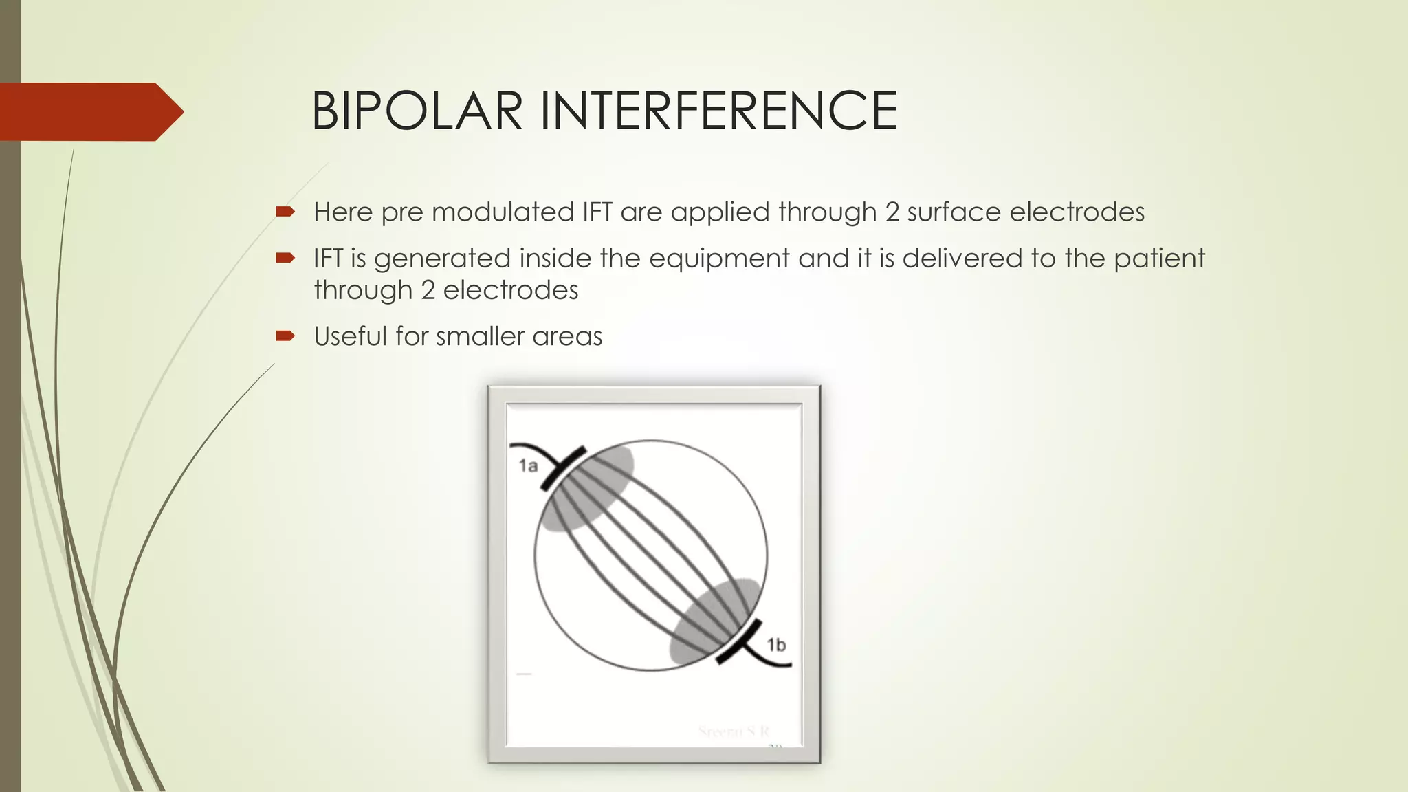Interferential therapy | PDF