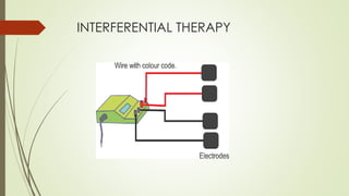 Interferential therapy | PDF