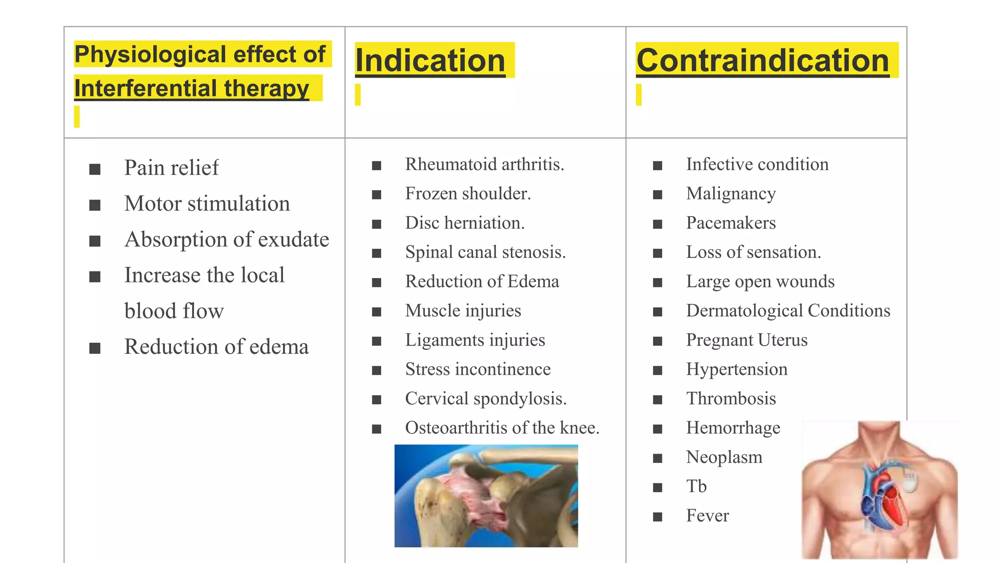 Interferential Therapy.pptx