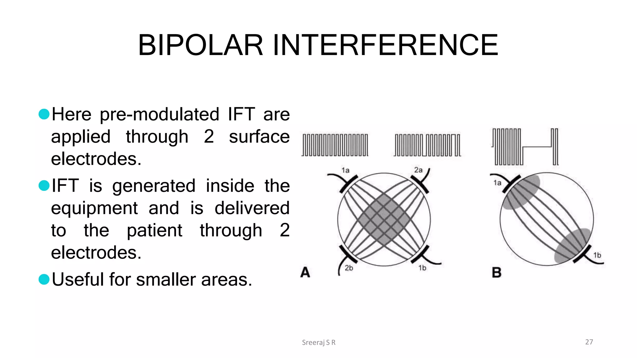 interferentialtherapys).pptx