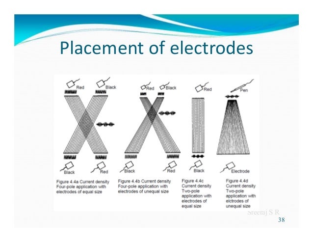 Interferential therapy