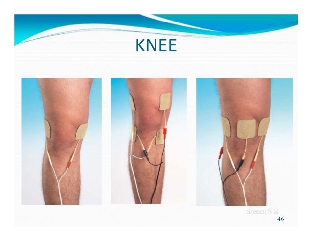 Interferential therapy