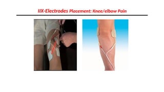 interfernatial_therapy part 2 electro.ppt