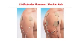 interfernatial_therapy part 2 electro.ppt