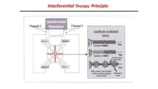interfernatial_therapy part 2 electro.ppt