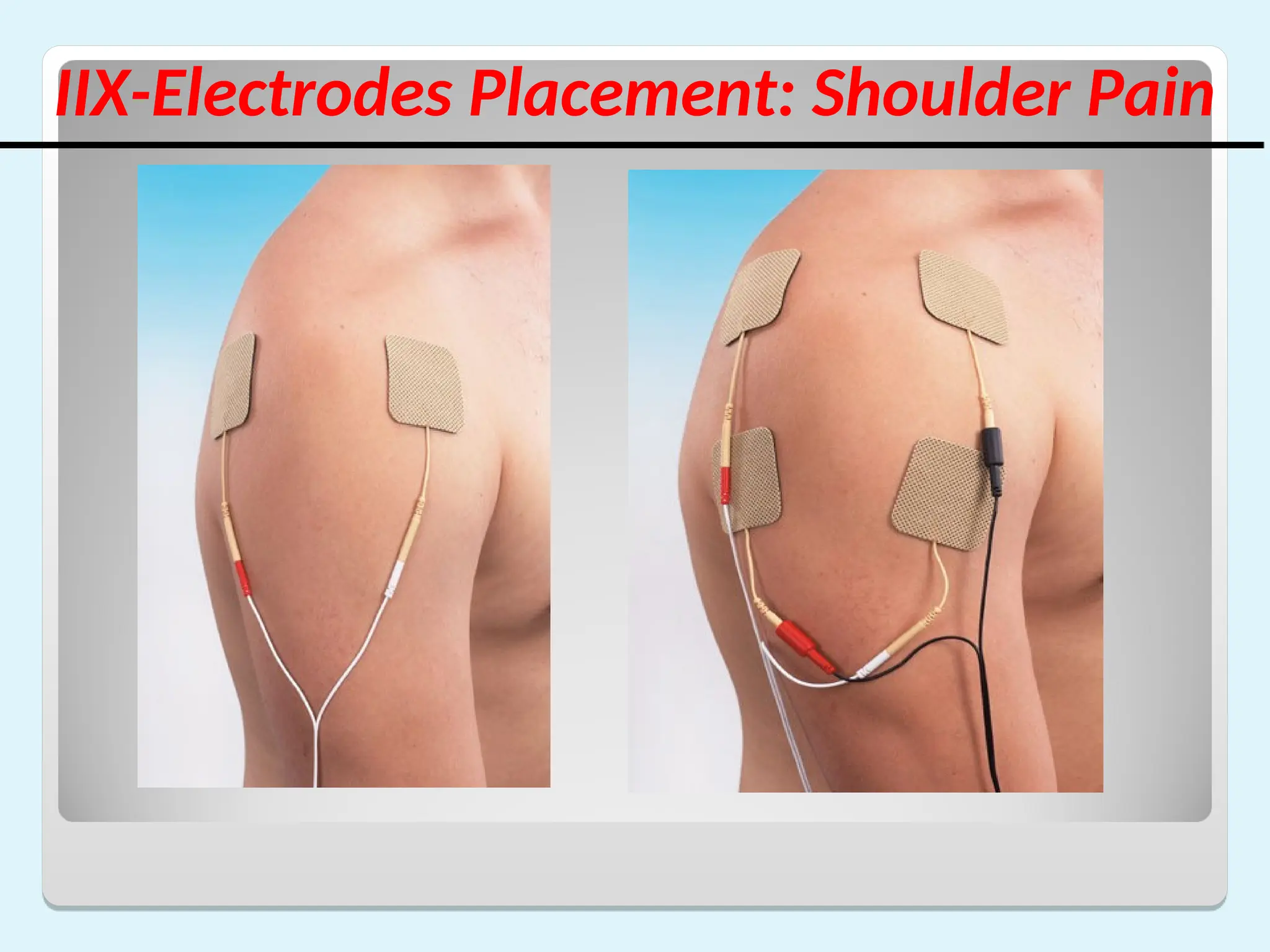 interfernatialtherapy electromodality.ppt