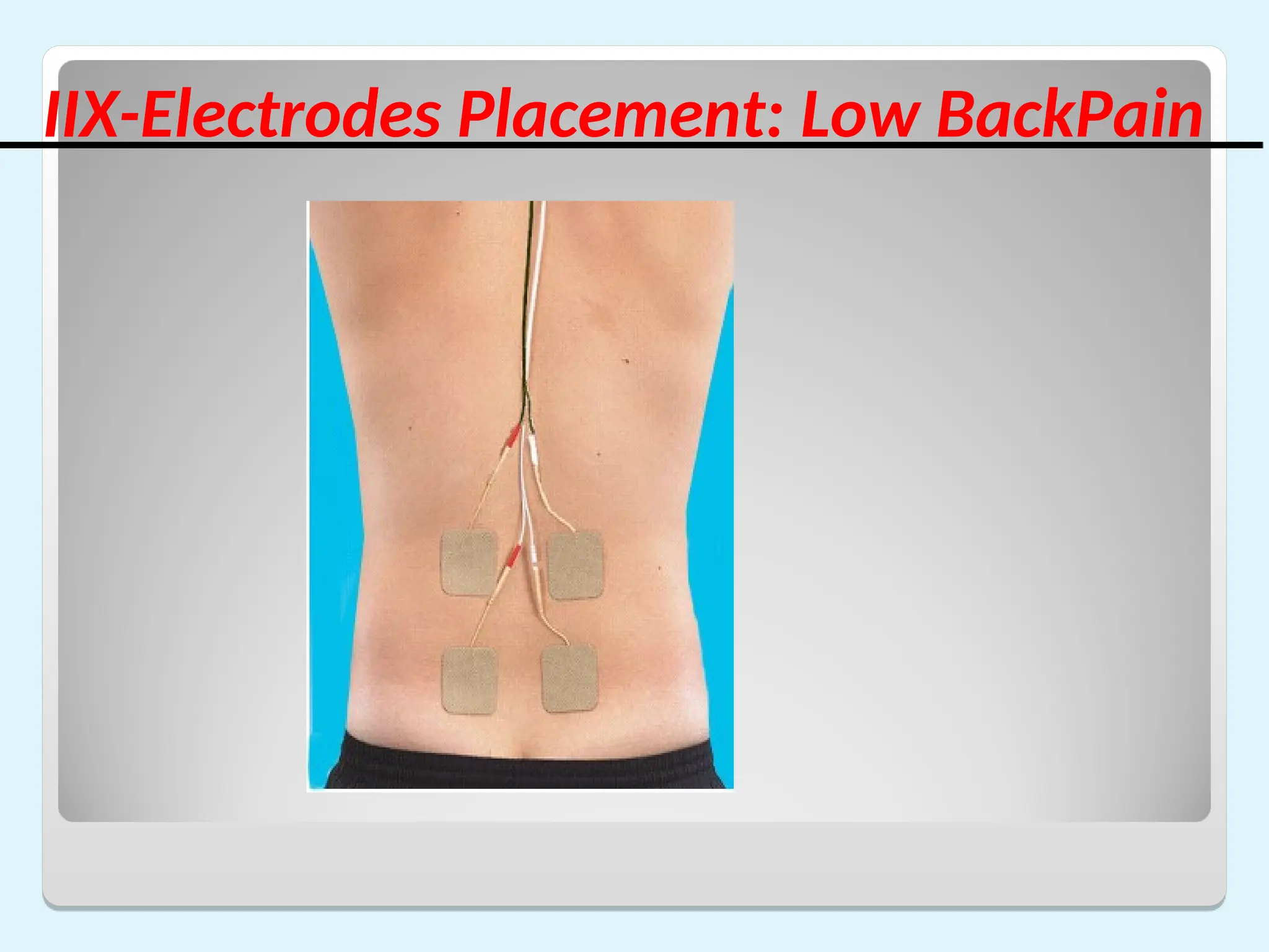 interfernatialtherapy electromodality.ppt