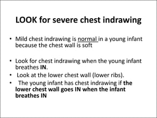 INTERGRATED MANAGEMENT OF CHILDHOOD ILLNESS(IMCI).pdf