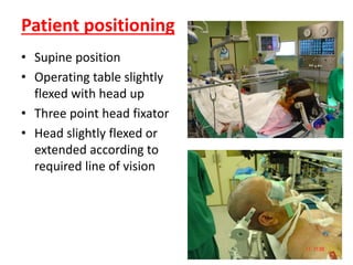 Surgical approach for tumors in the lateral and third ventricle | PPTX
