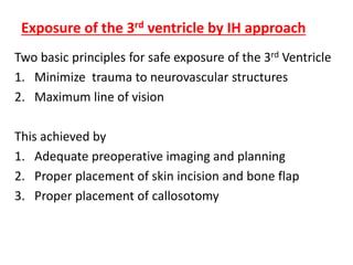 Surgical approach for tumors in the lateral and third ventricle | PPTX