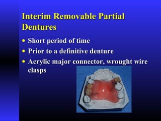 interim removable partial dentures | PPT