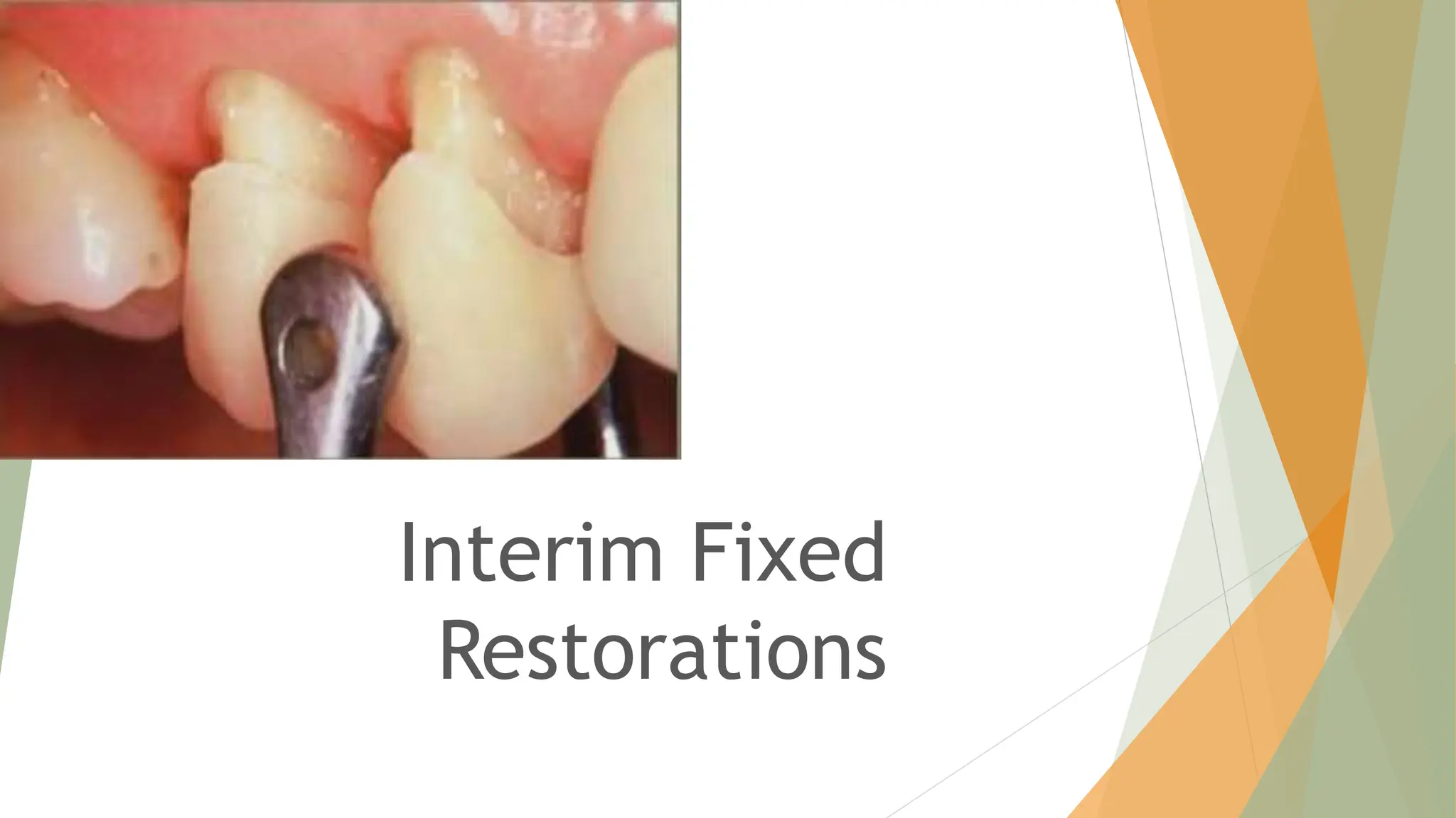 Interim Fixed Restorations.pptx