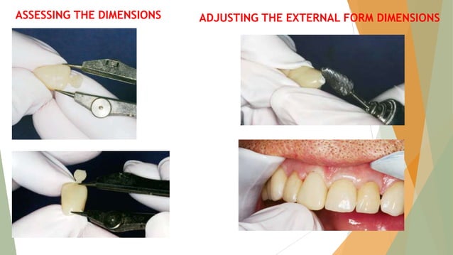 Interim Fixed Restorations.pptx
