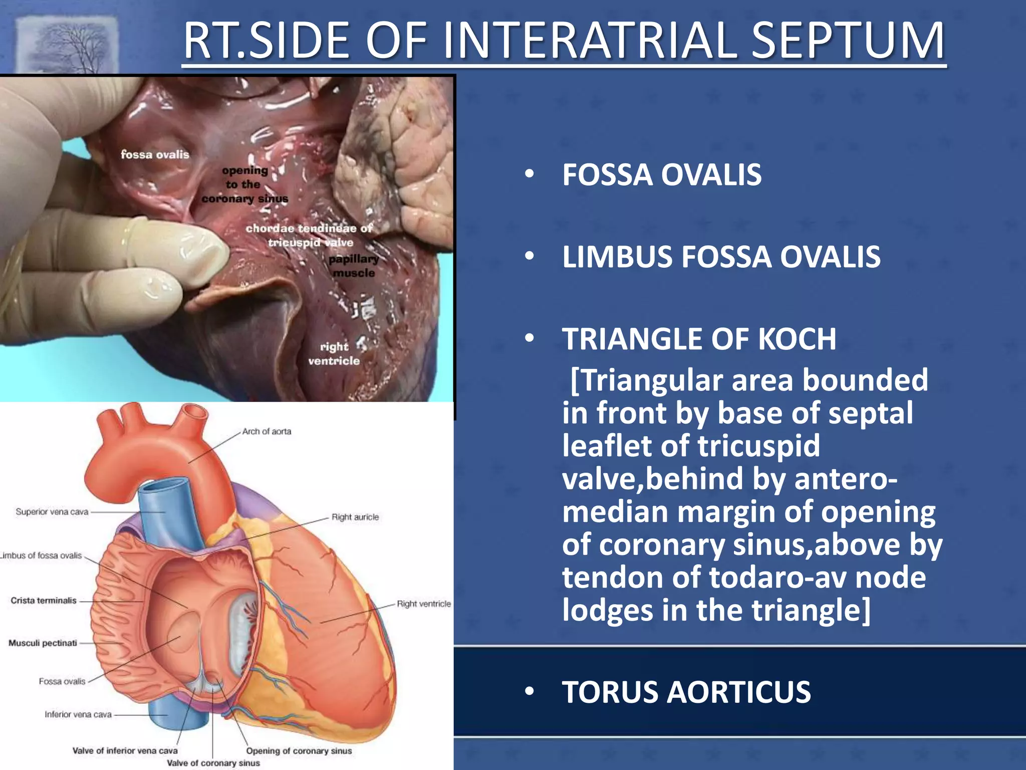 INTERIOR OF HEART.ppt